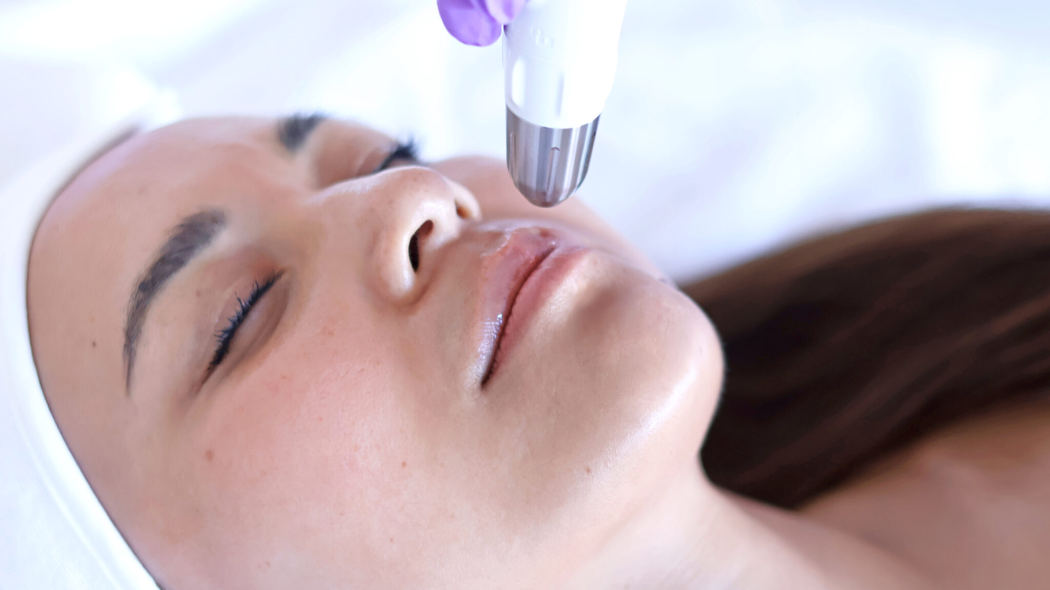 Beauty & More: Facial Treatments - Dermadrop